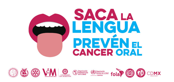 ¿Cáncer oral? Odontología realiza la campaña “Saca la Lengua”