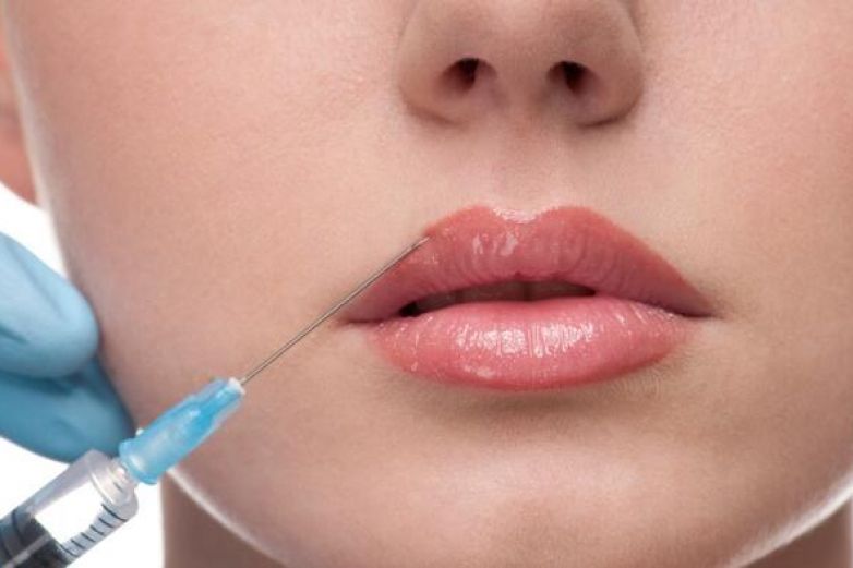 ¿Quieres labios carnosos? Conoce todo acerca de los rellenos faciales