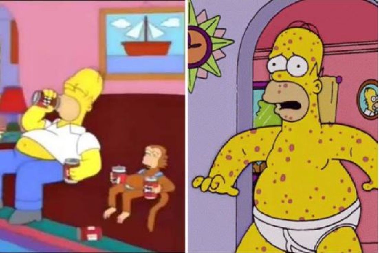 ¿Los Simpson predijeron la viruela del mono? Aquí te contamos ¿Los Simpson predijeron la viruela del mono? Aquí te contamos