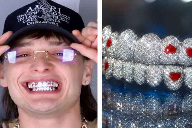 Peso Pluma estrena dentadura de diamantes; pagó un millón de pesos por ella