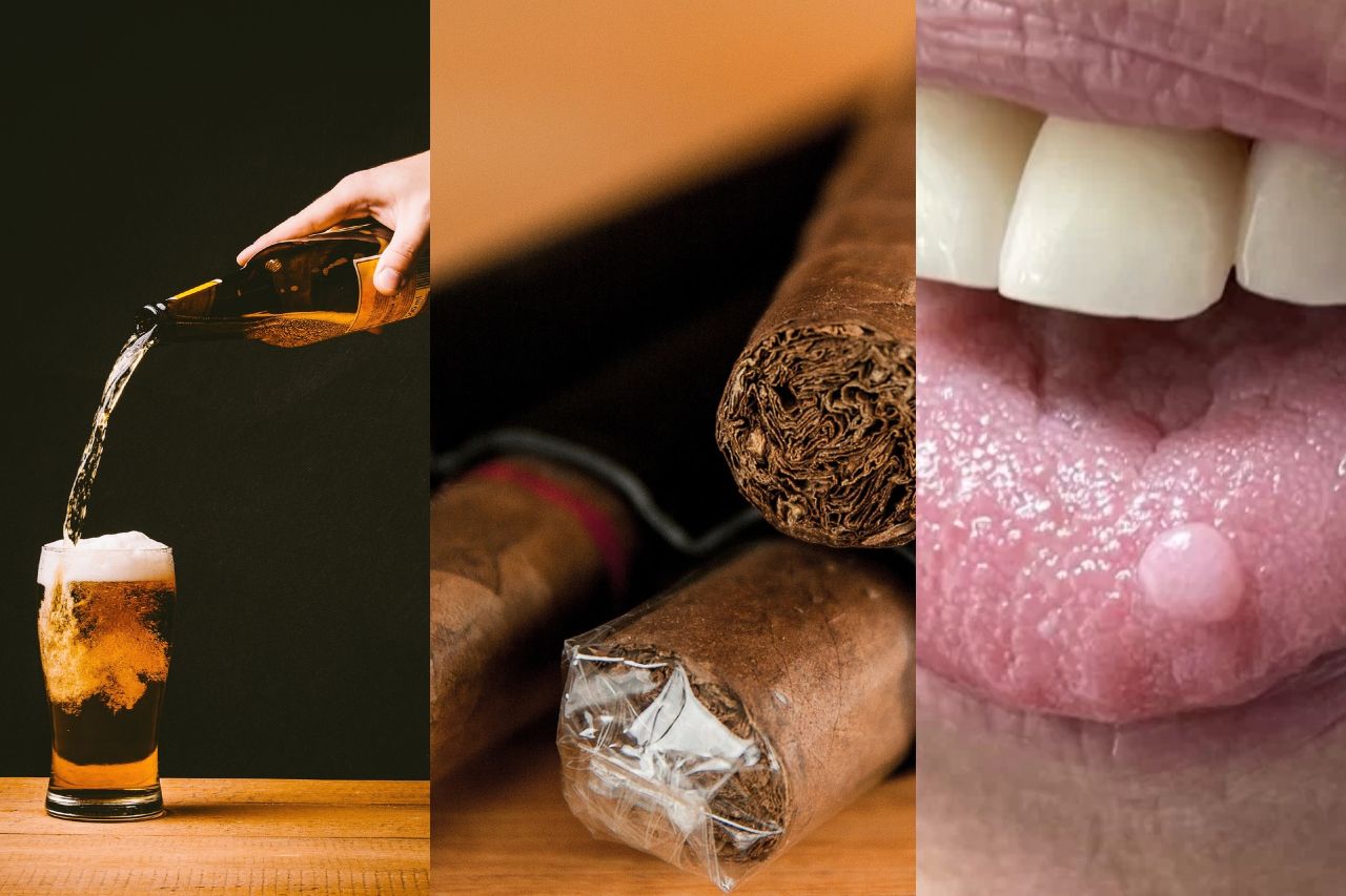 Riesgo de cáncer en cabeza y cuello aumenta con el alcohol, tabaco y VPH