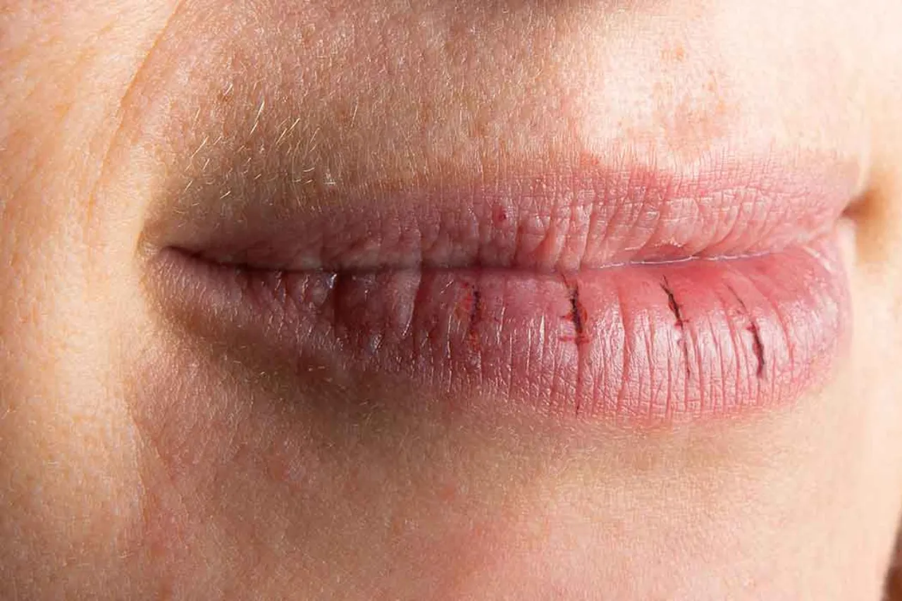 Labios suaves y protegidos: Consejos para evitar que se partan en invierno