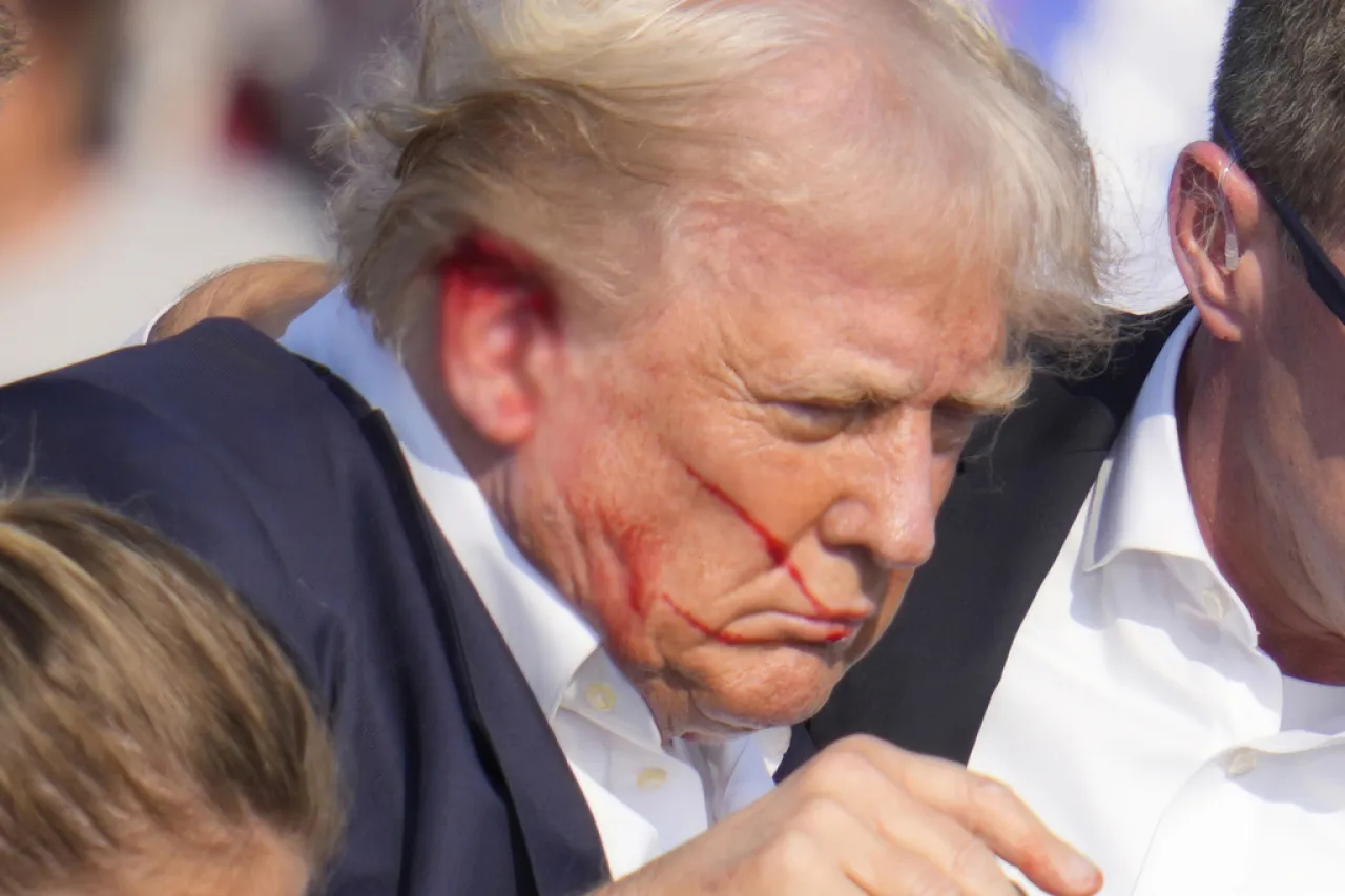 Trump perdió un pedazo de su oreja tras atentado