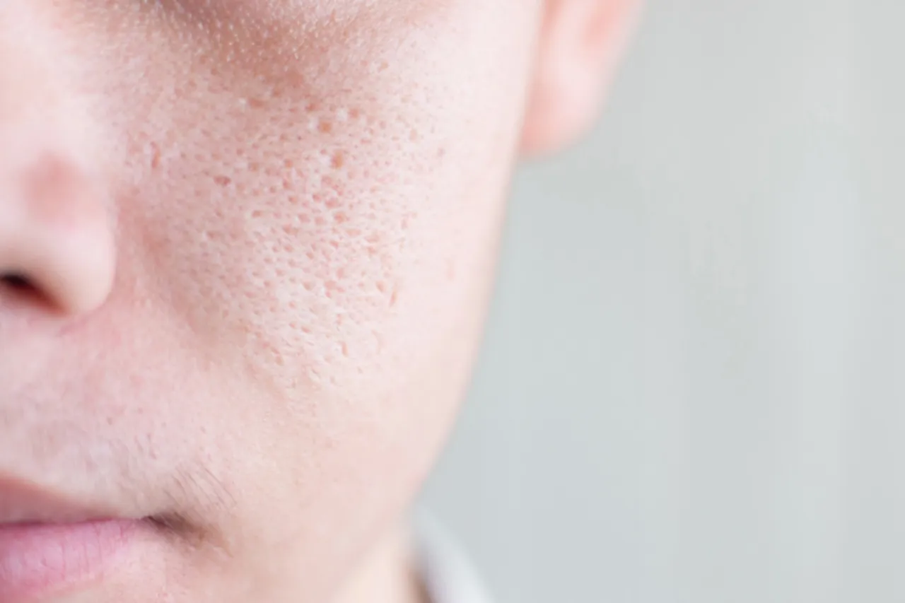 Bye, poros abiertos: transforma tu rostro con estos tips