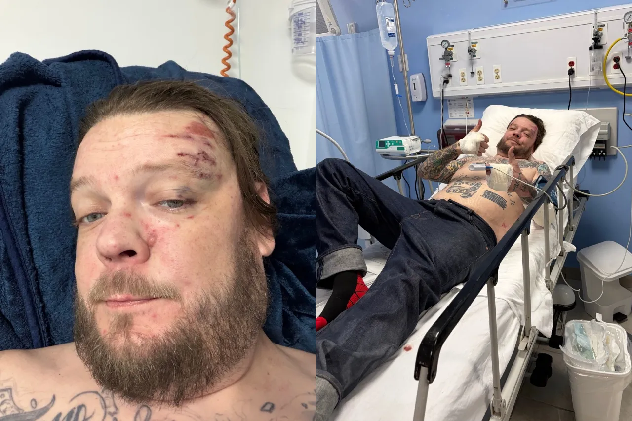 Hospitalizan a Corey Harrison tras accidente en Tulum